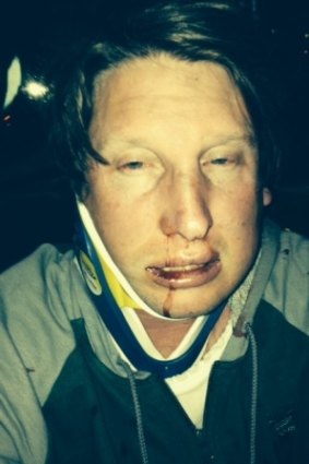 Man bashed after MCG clash