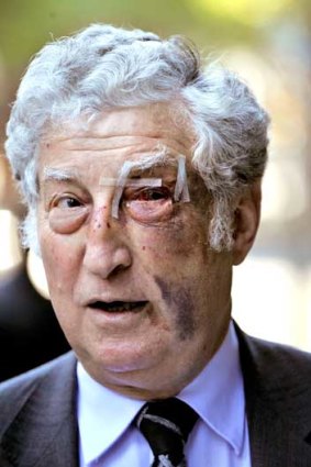 Lawyer Alex Lewenberg attacked with baseball bat, court told