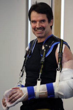 Patient's delight at world-first full arm transplants