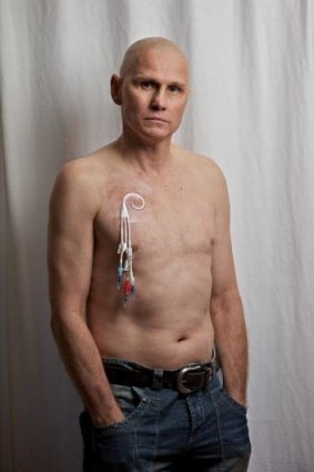 Boxer Troy Waters takes on the fight of his life against leukaemia