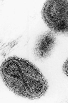 Smallpox found in Washington DC storage room