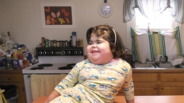 Maine girl with 'mermaid syndrome' dies at 10