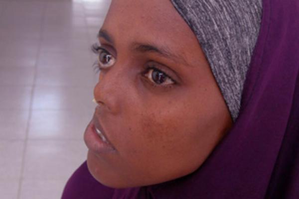 Generosity brings Somali woman to Brisbane for facial reconstruction