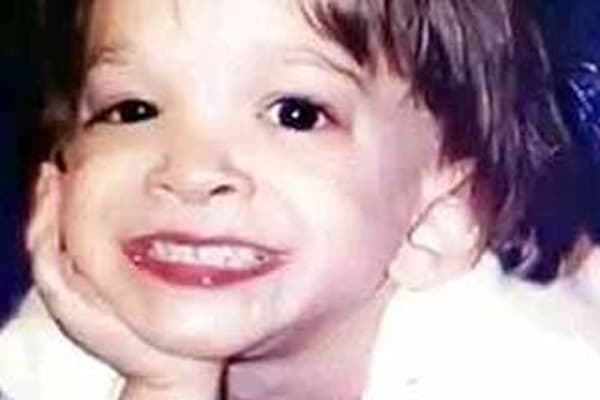 syndrome-x-brooke-greenberg-dies-aged-20-but-still-a-toddler
