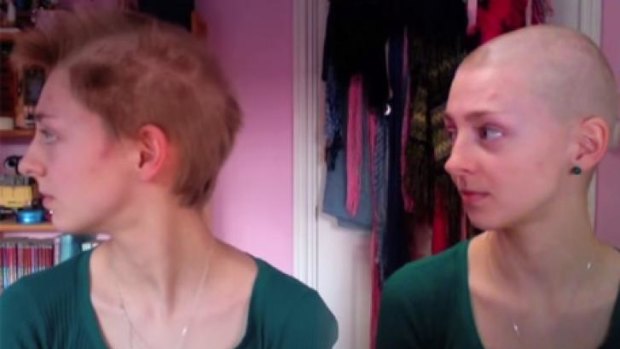 Woman who uncontrollably ripped her hair out becomes internet sensation