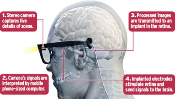 Research solutions for a bionic eye may be closer than they appear