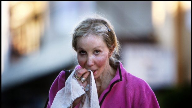 Notorious banned cosmetic surgeon charged with practising on patients ...