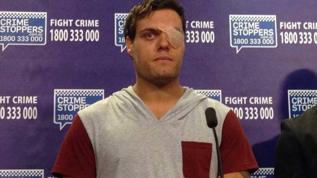 Unprovoked attack leaves Perth mechanic blind