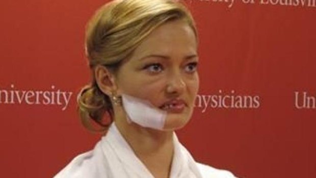 Hole repaired in woman's face caused by radiation treatments for a ...