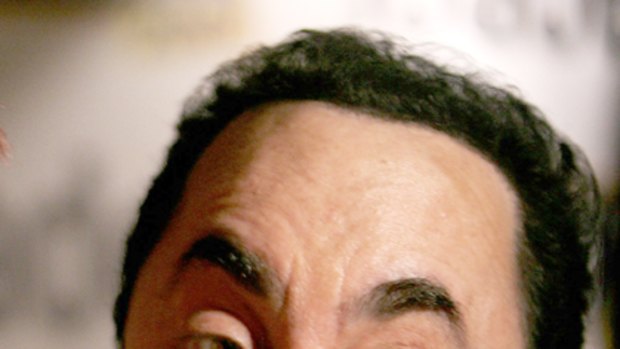 David Gest's plastic surgery disaster