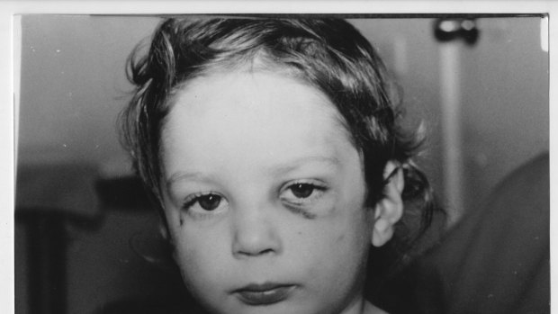 A Melbourne toddler died. Another little boy could have. Why?