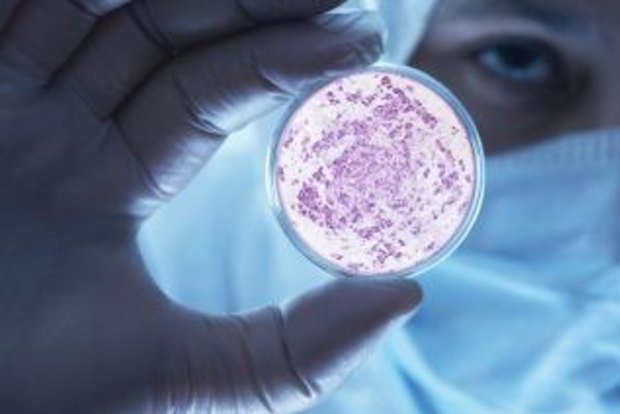 Life-threatening Chromobacterium violaceum infection explained