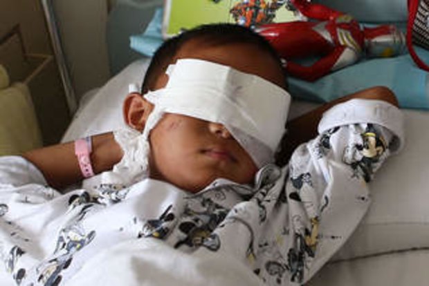 Boy's eyes gouged out: suspect dead, say police