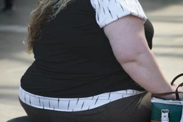 Extreme obesity the new normal