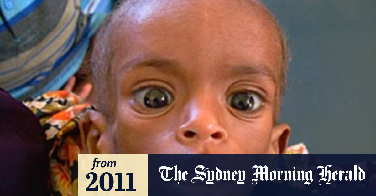Starving children wait weeks for rations