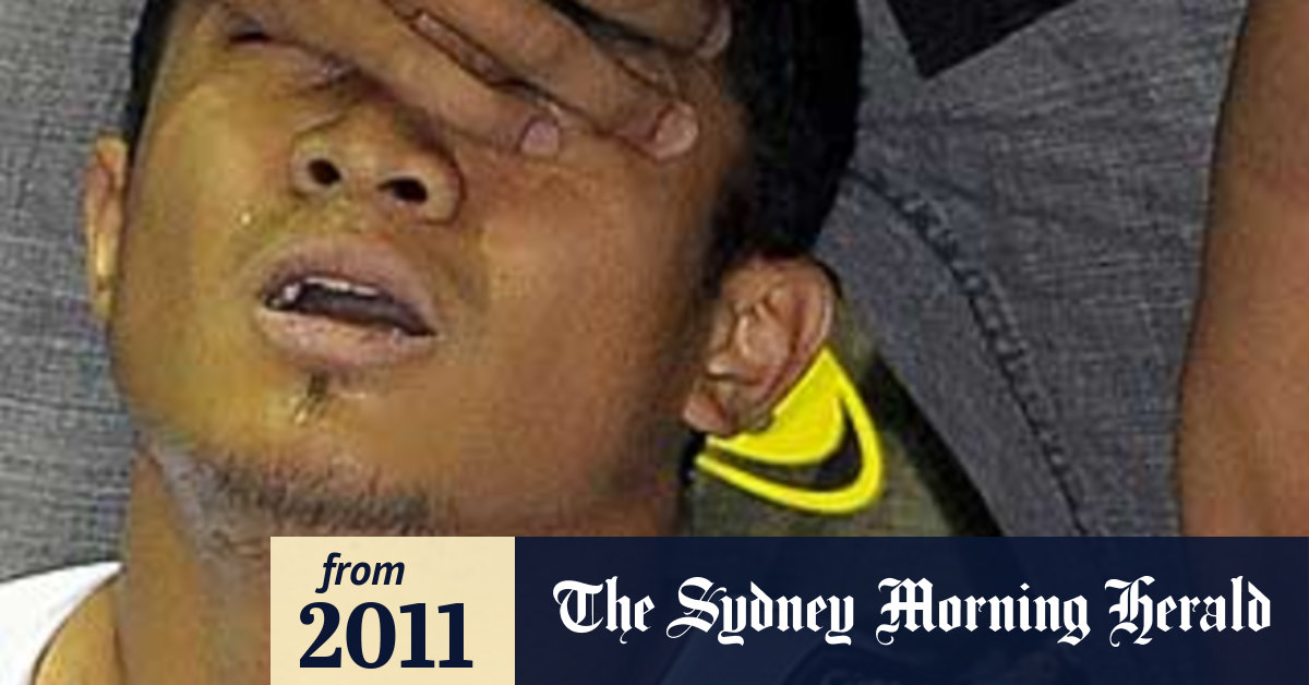 Malaysia cyclist has giant splinter removed from leg