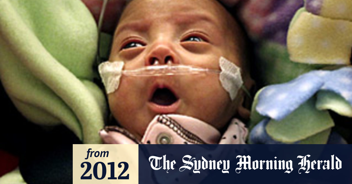 Born at 270 grams, baby Melinda finally ready for home