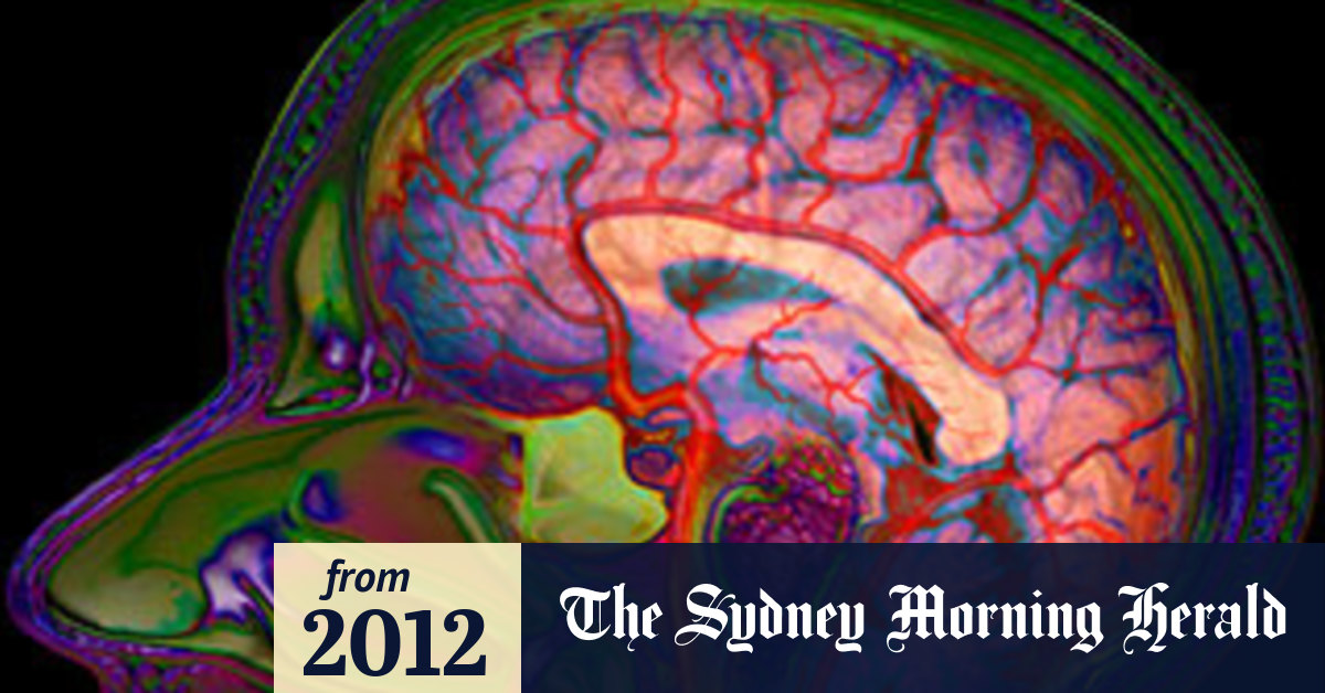 Google's 'brain simulator': 16,000 computers to identify a cat