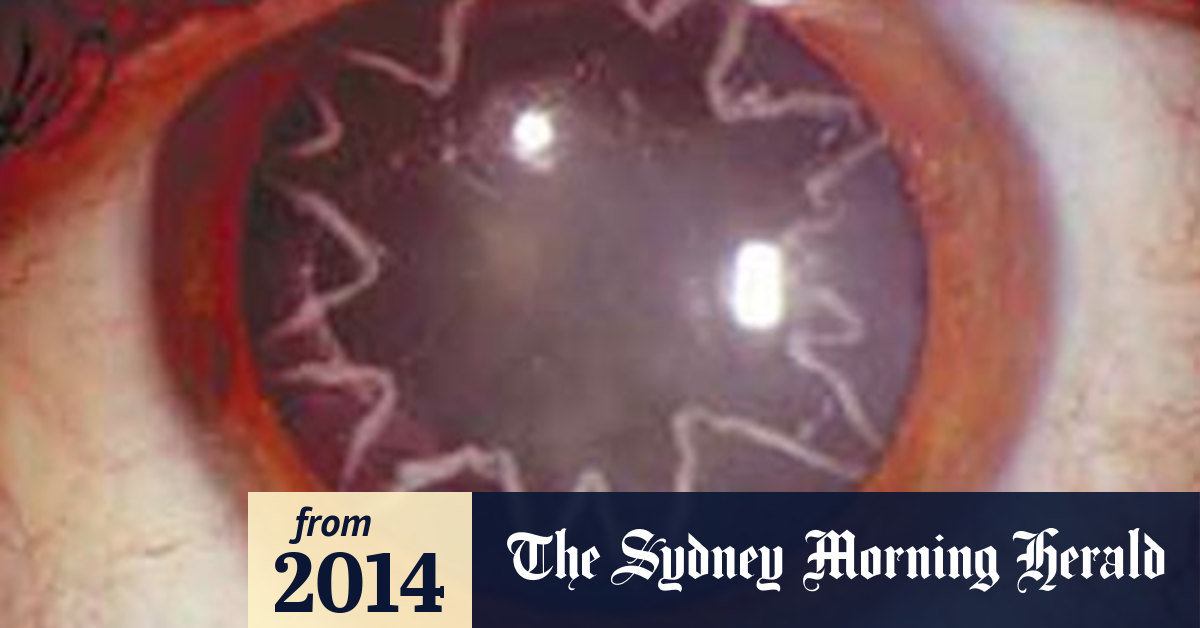 Stars form in electrician's eyes after powerful shock