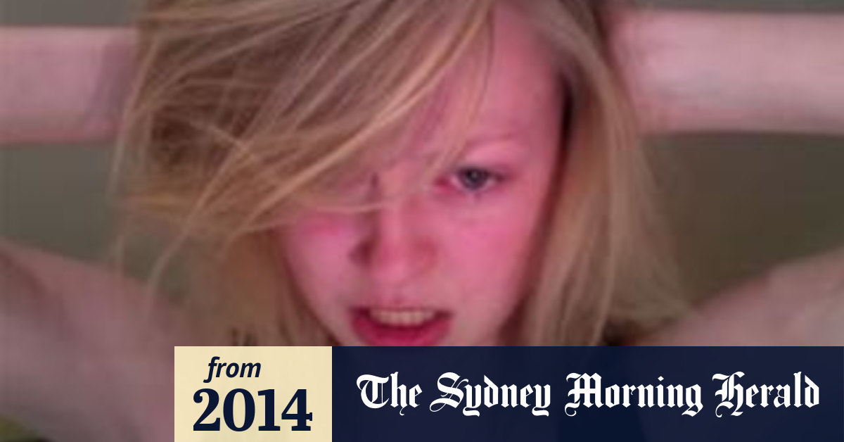 Woman who uncontrollably ripped her hair out becomes internet sensation