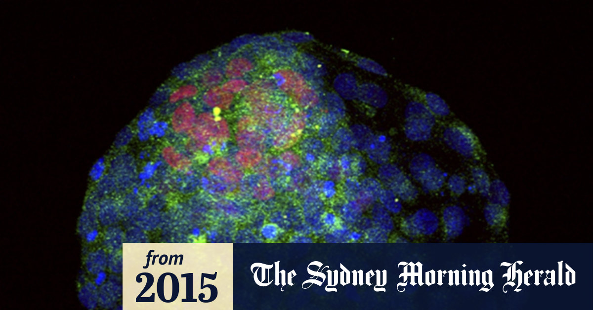 Retrovirus: Ancient virus fossils may be immunising us from the inside