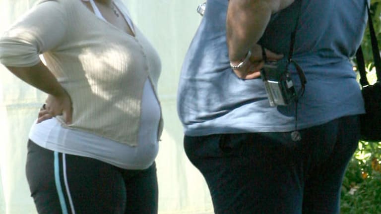 Extreme obesity the new normal