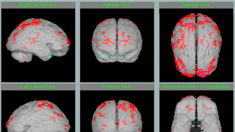 'Scared and scary': how trauma changes a child's brain