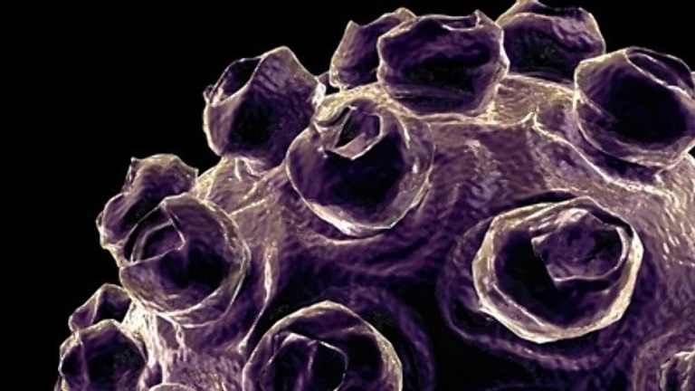 New measles case spent time travelling around Sydney while infectious ...