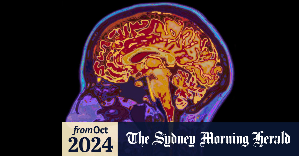 Are left-wing and right-wing brains wired differently?