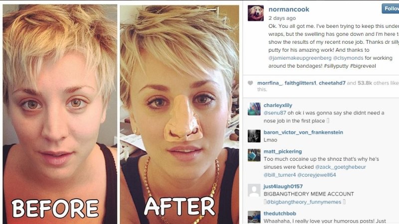 Kaley Cuoco thumbs her nose at plastic surgery rumours