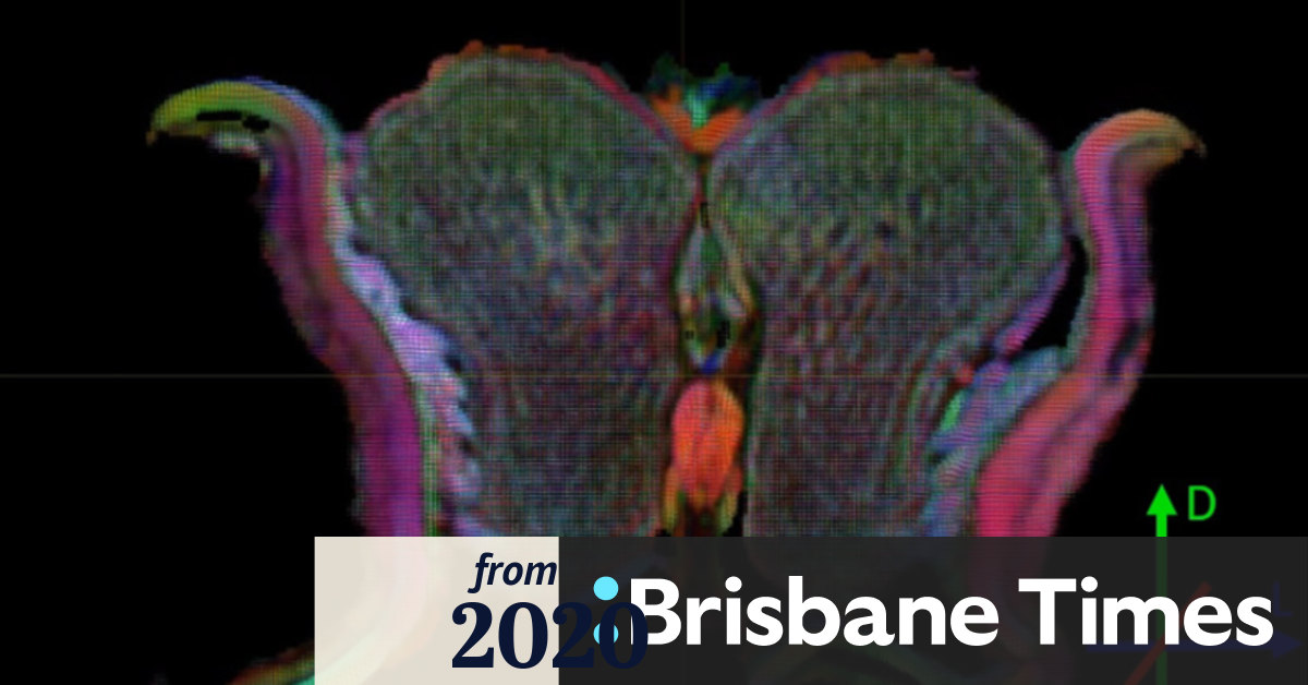 Video: Watch: a detailed map of squid brains