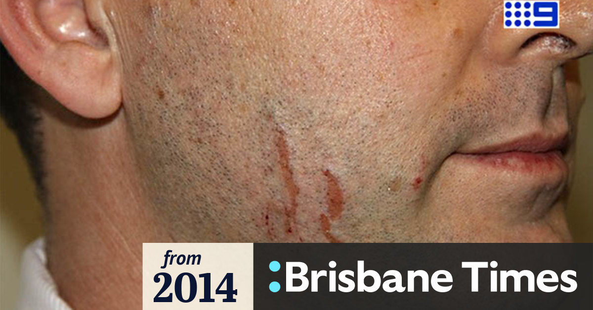 Video: Face injury 'looks suspicious'