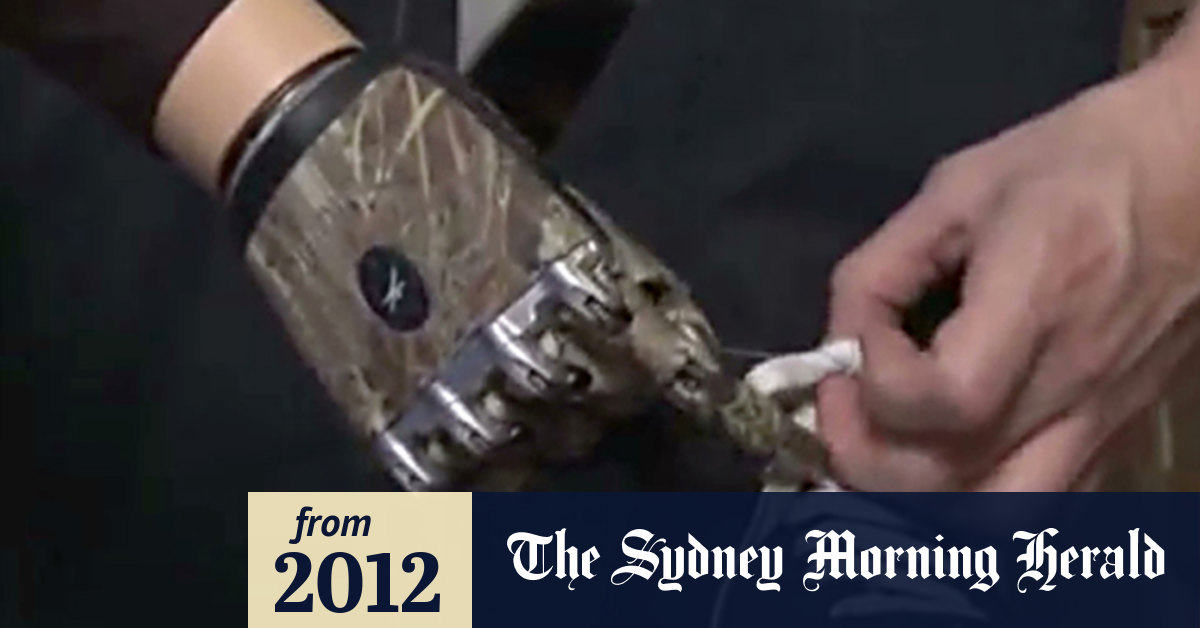 Video: UK bionic hand to hit mass market