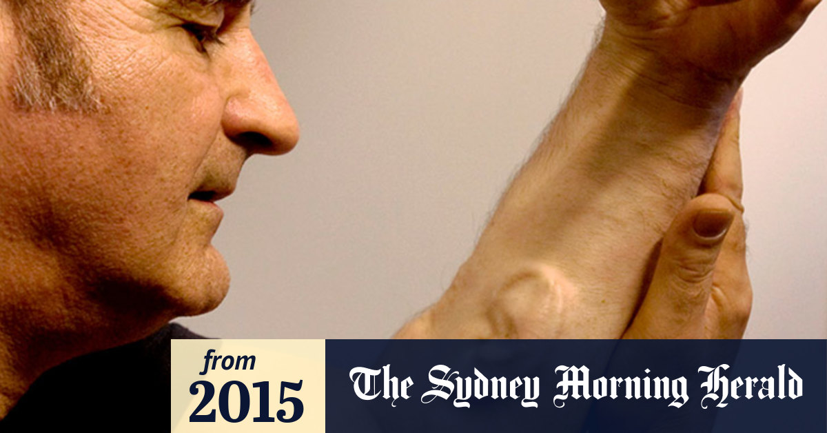 Video: Ear grown on arm to become a radio