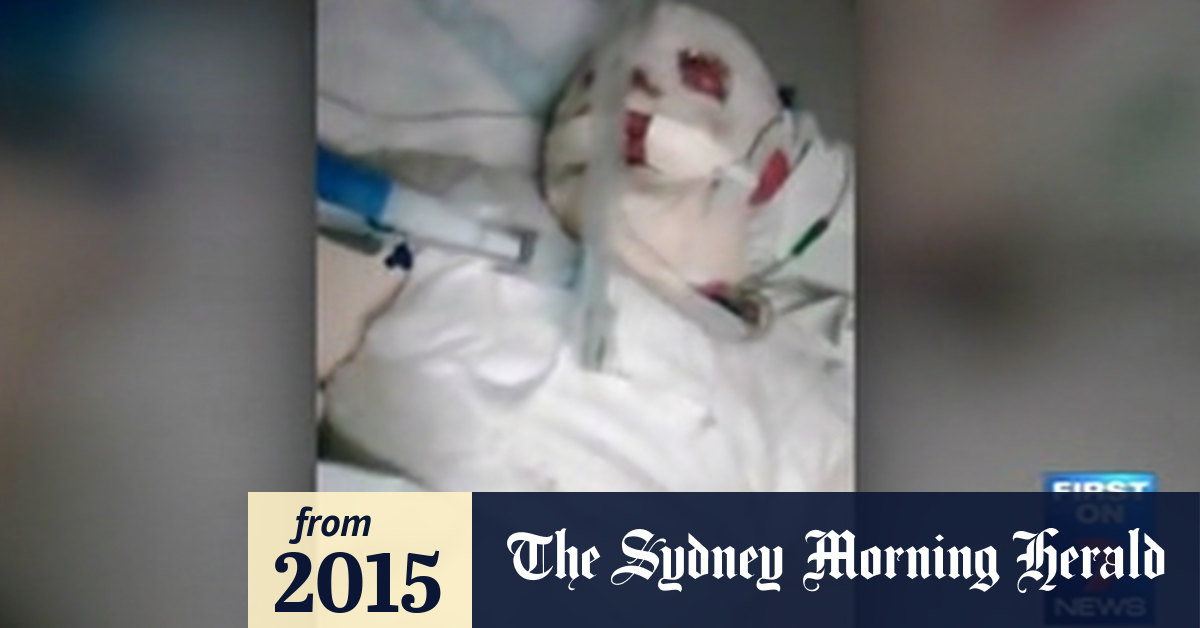 Video: Teen suffers horrific burns at KFC outlet