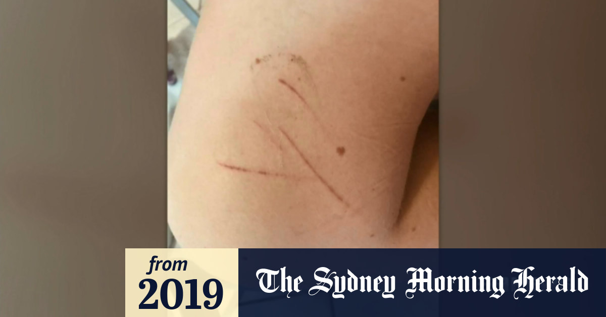 Video: Students attacked with razor blade at high school