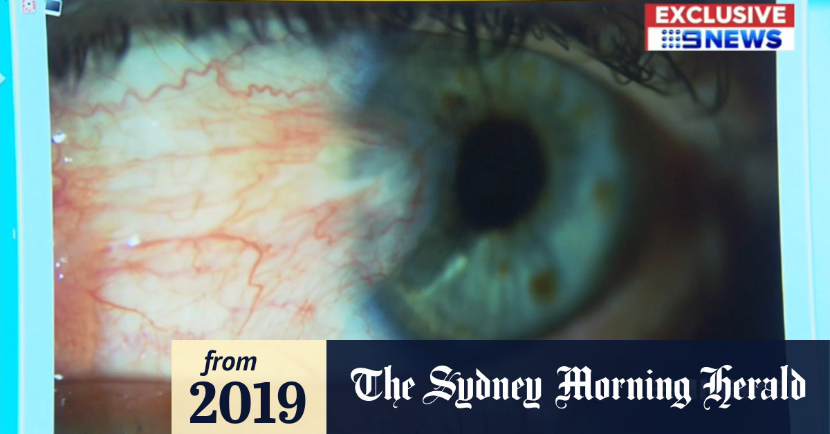 Video: New eye drops to treat sun damage