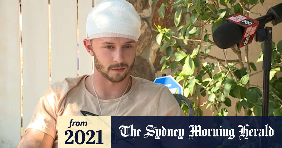 Video: Florida man recounts terrifying alligator attack