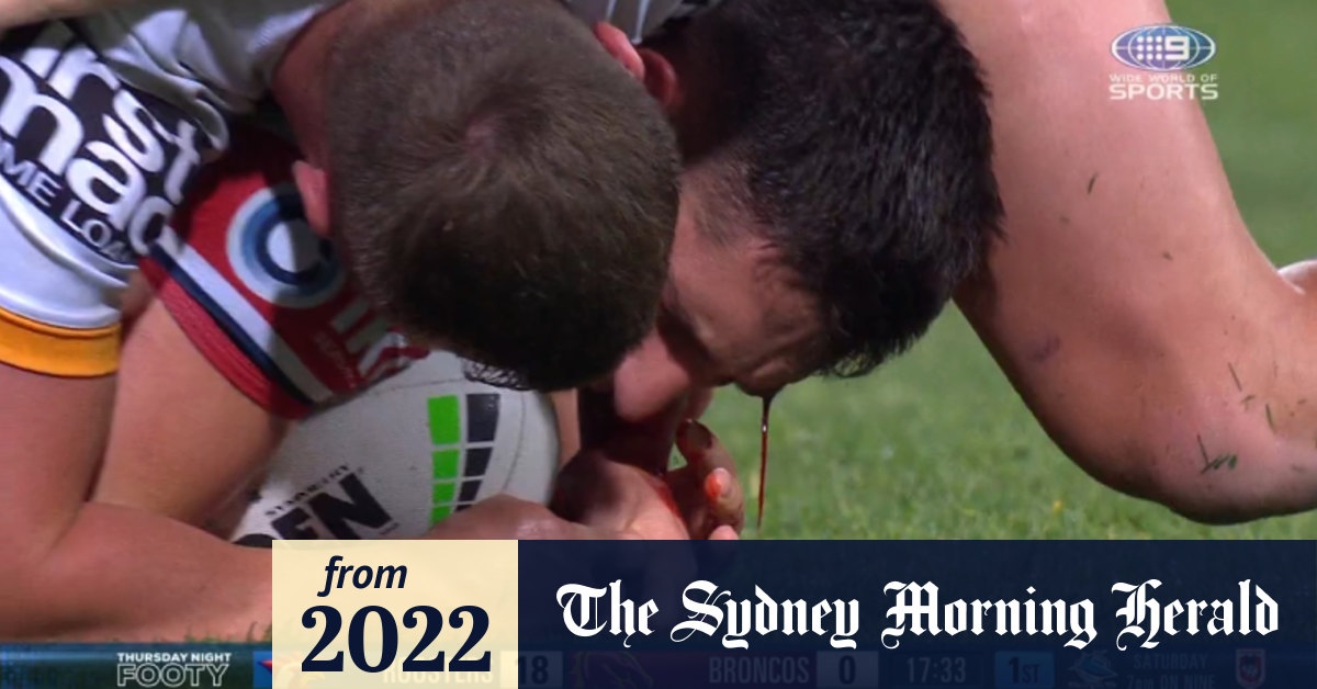 Video: Radley's head split open in head clash