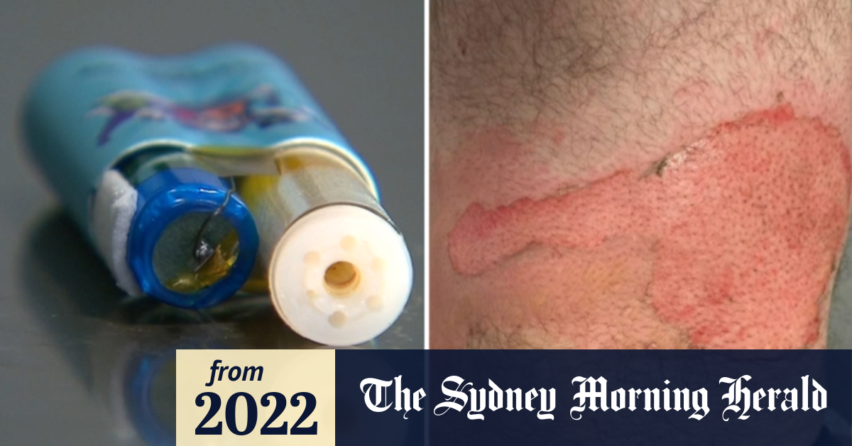 Video: Victorian man scarred after vape exploded inside pocket
