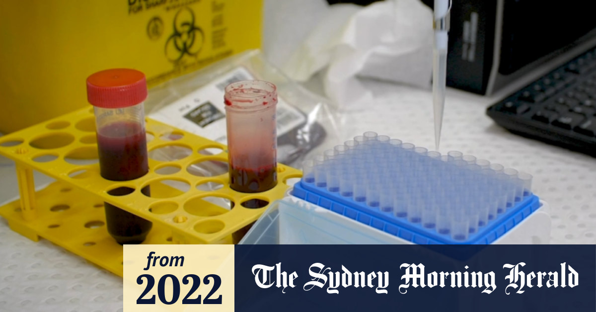 Video: Venom gel: How deadly snakes could soon save lives and heal wounds