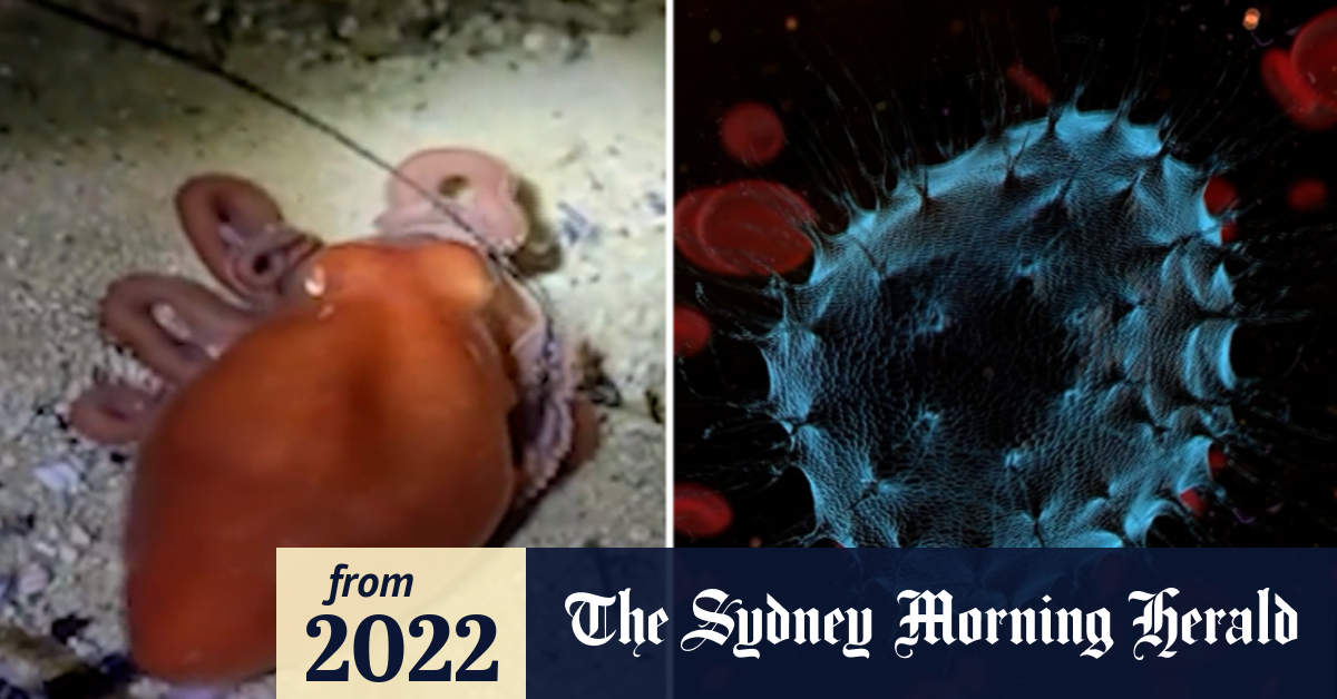 Video: Octopus venom could help fight melanoma, study finds