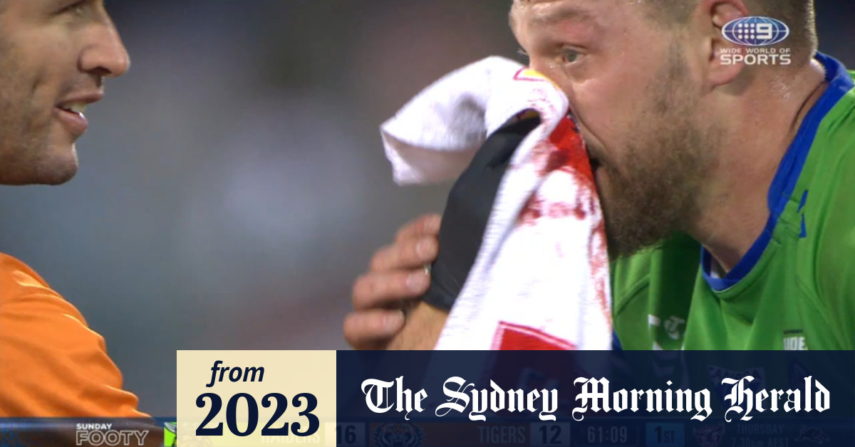 Video: 'Busted nose' fears after brutal clash