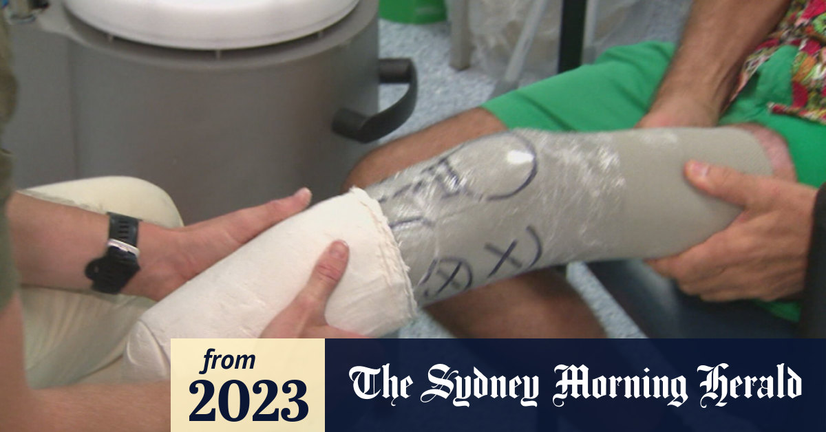 Video: Brisbane hospital offers new groundbreaking prosthetic leg ...