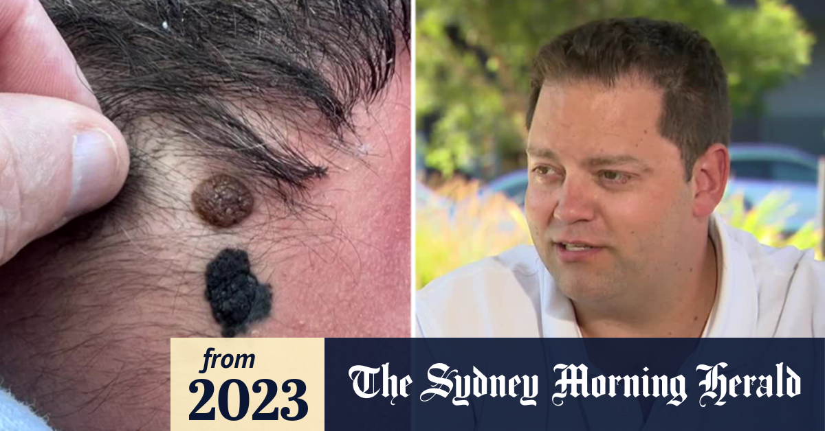 Video: Homeowner saves tradie's life after spotting suspicious mole