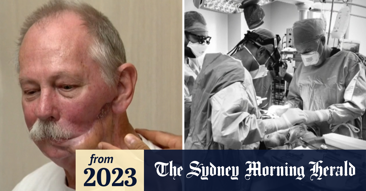 Video: Man first to receive printed jaw in Queensland