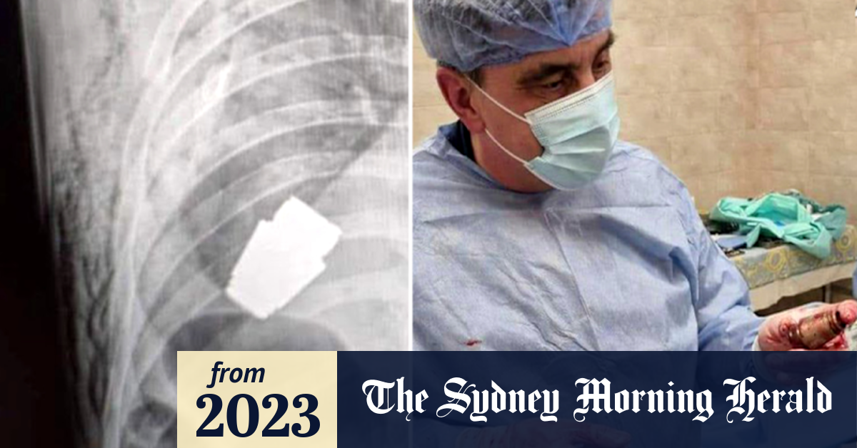 Video: Doctors remove an unexploded grenade from Ukraine soldier's chest