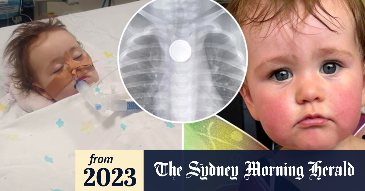 Video: Qld baby who swallowed button battery breathes unassisted