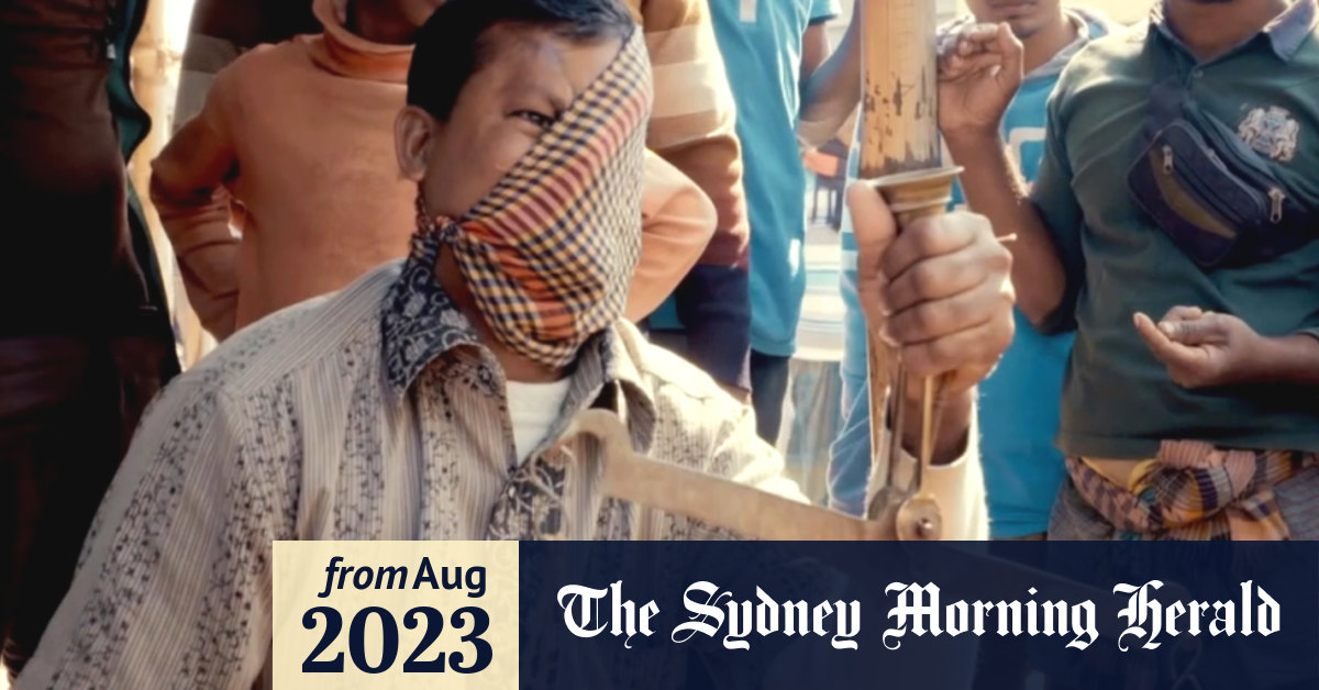 Video: Hashmot reveals what life is like after he was mauled by a tiger