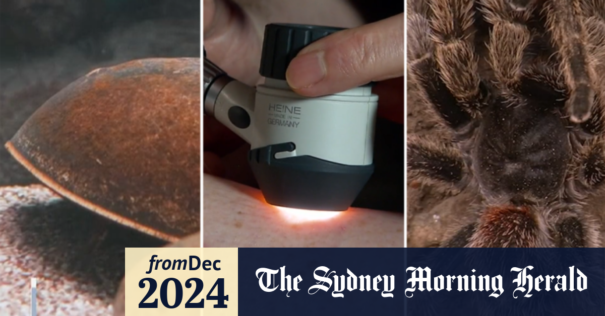 Video: Scientists using spiders and crabs to fight melanoma